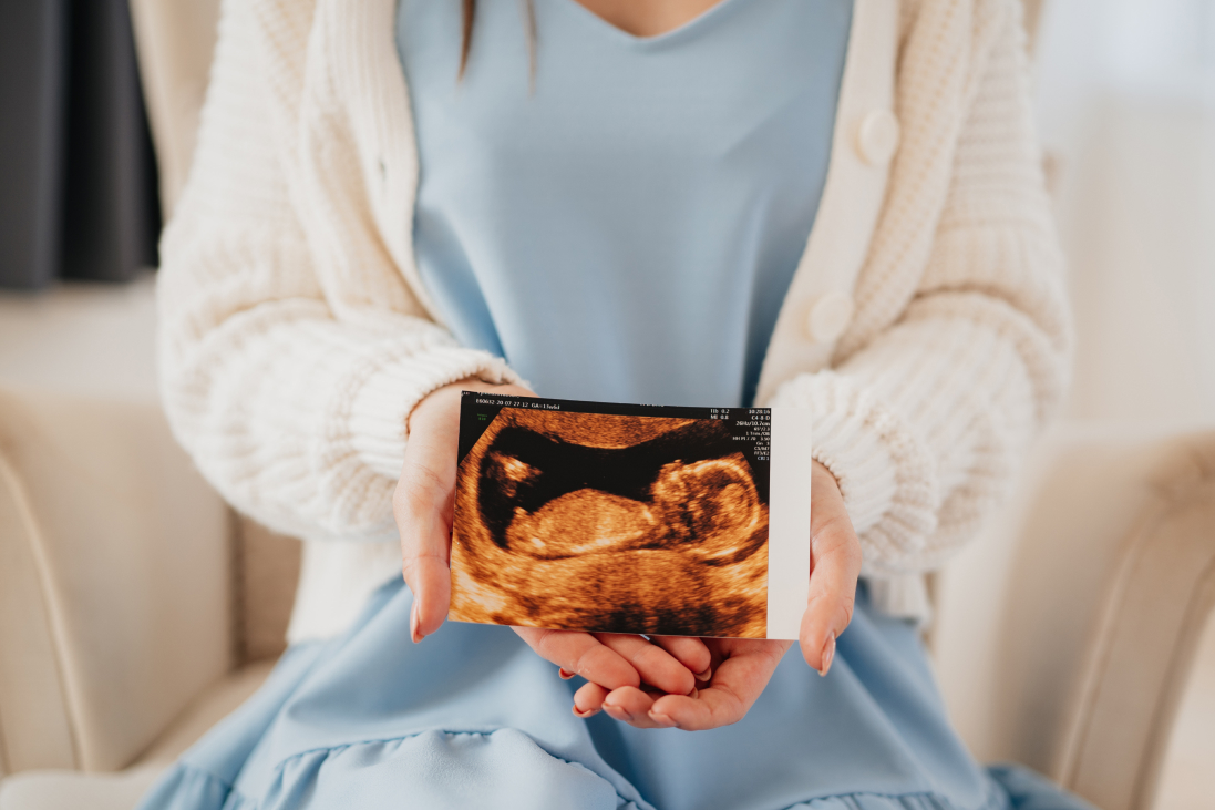 Darování spermií - darujte život | Repromeda